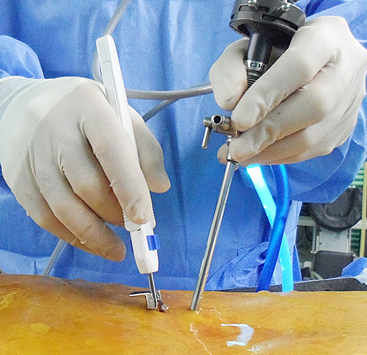 Enhancing Surgical Precision: Unilateral Biportal Endoscopy Market is ...