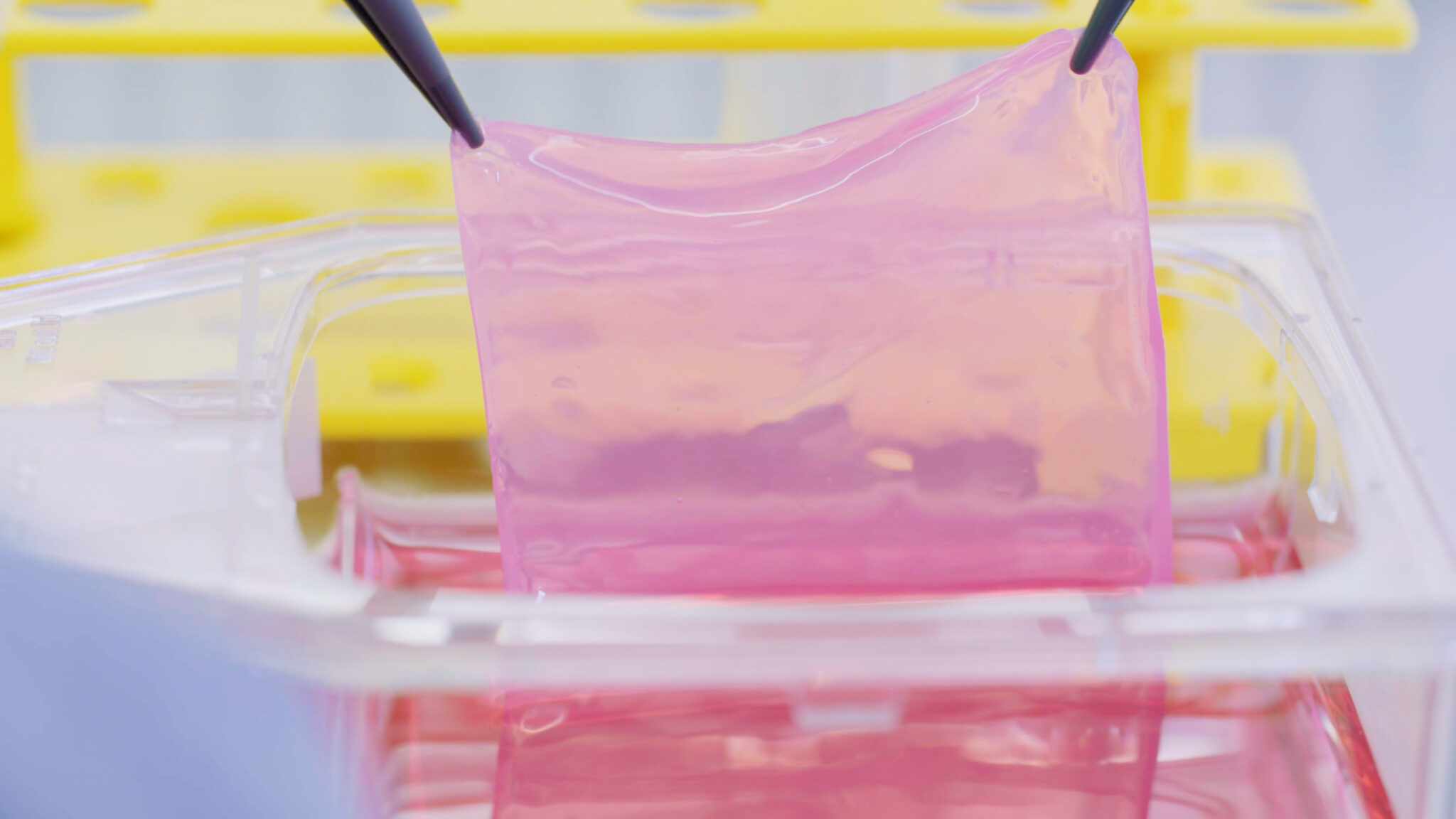 Global Tissue Engineered Skin Substitute Market Continues Upward ...