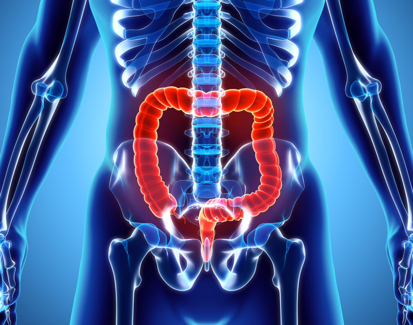 Global Intestinal Fistula Treatment Market to Hit USD 46.82 Billion by ...