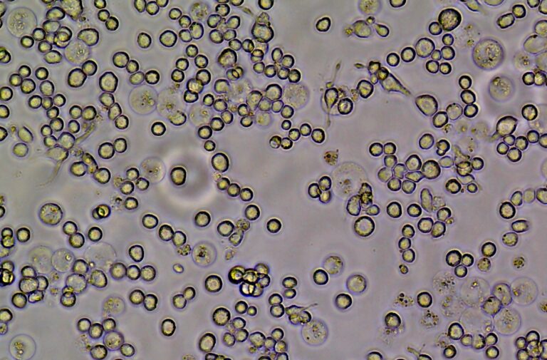 Global Insect Cell Lines Market is expected to grow at a CAGR of 11.6% ...