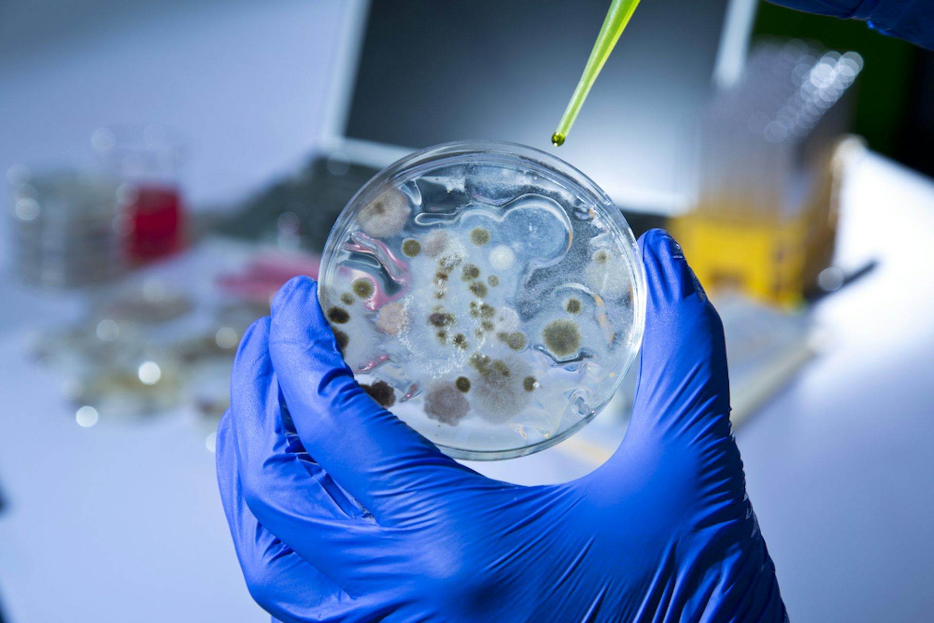 Global Microbial Identification Market Set for Remarkable Growth ...