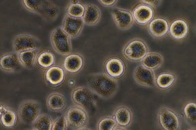 Insect Cell Lines Market Set to Reach USD 3 Billion by 2033, Growing at ...