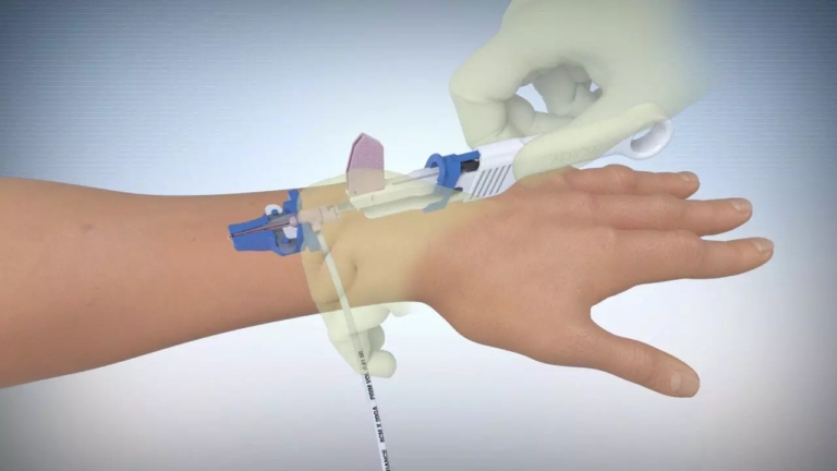 Global IV Therapy and Vein Access Devices Market to Reach USD 47.3 ...