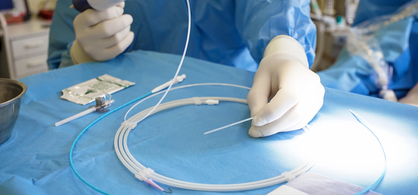 Neurovascular Guidewires Industry Set for Steady Growth USD 399.1 ...