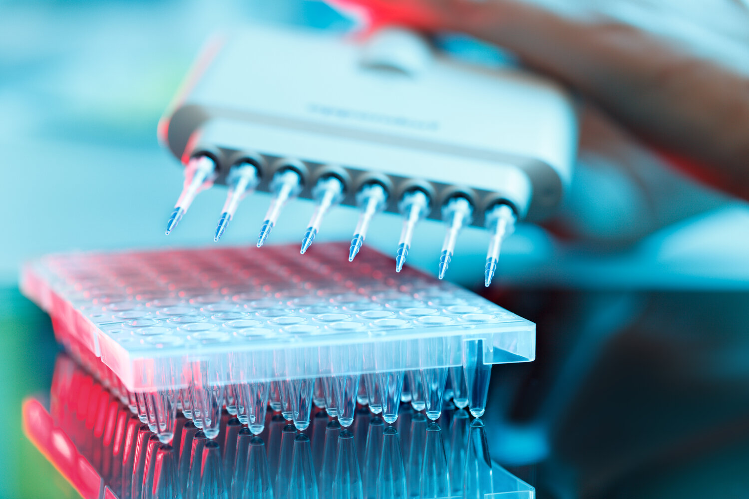 Global NGS Sample Preparation Market Set for Remarkable Growth ...